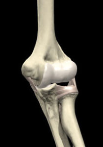 Loose Bodies in the Elbow – Orthocentre